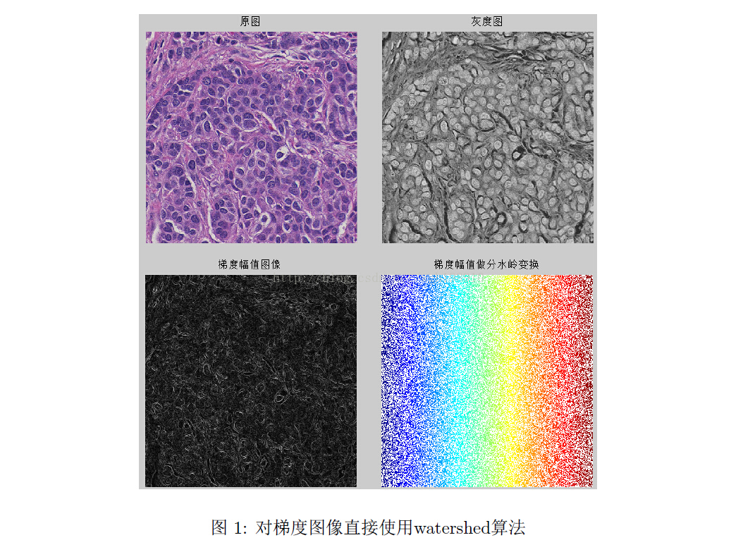 医学图像处理：基于标记的分水岭分割算法及算法评估分水岭算法对脑部图像的研究的评价指标 Csdn博客 