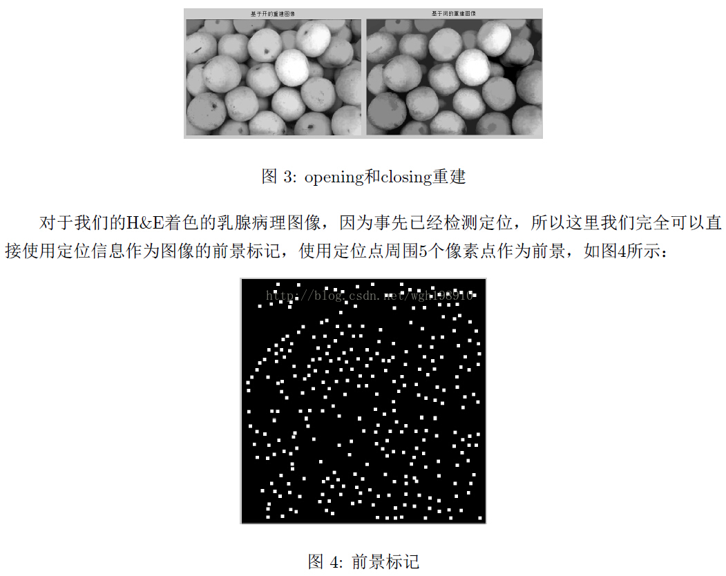 医学图像处理：基于标记的分水岭分割算法及算法评估分水岭图像分割评价指标 Csdn博客 1696