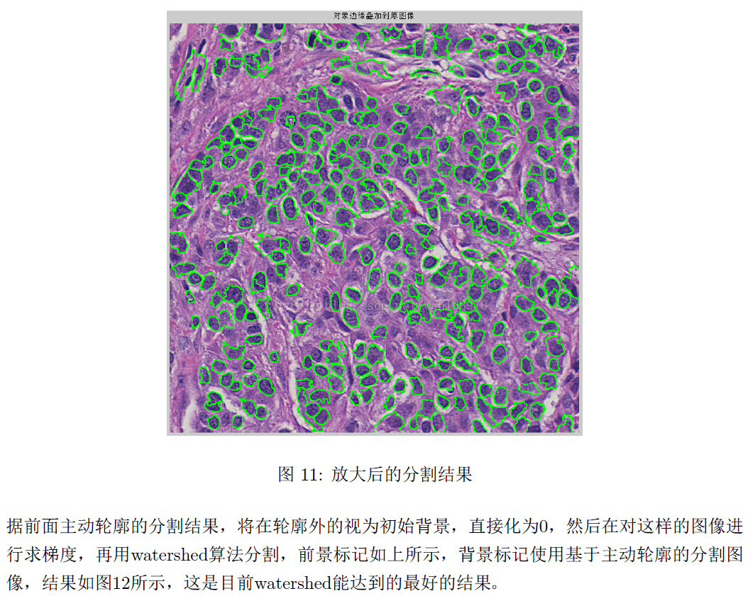 医学图像处理：基于标记的分水岭分割算法及算法评估分水岭图像分割评价指标 Csdn博客 4449