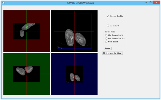 VTK Examples中MIP和MPR的功能实现与源码分析_vtk mip-CSDN博客