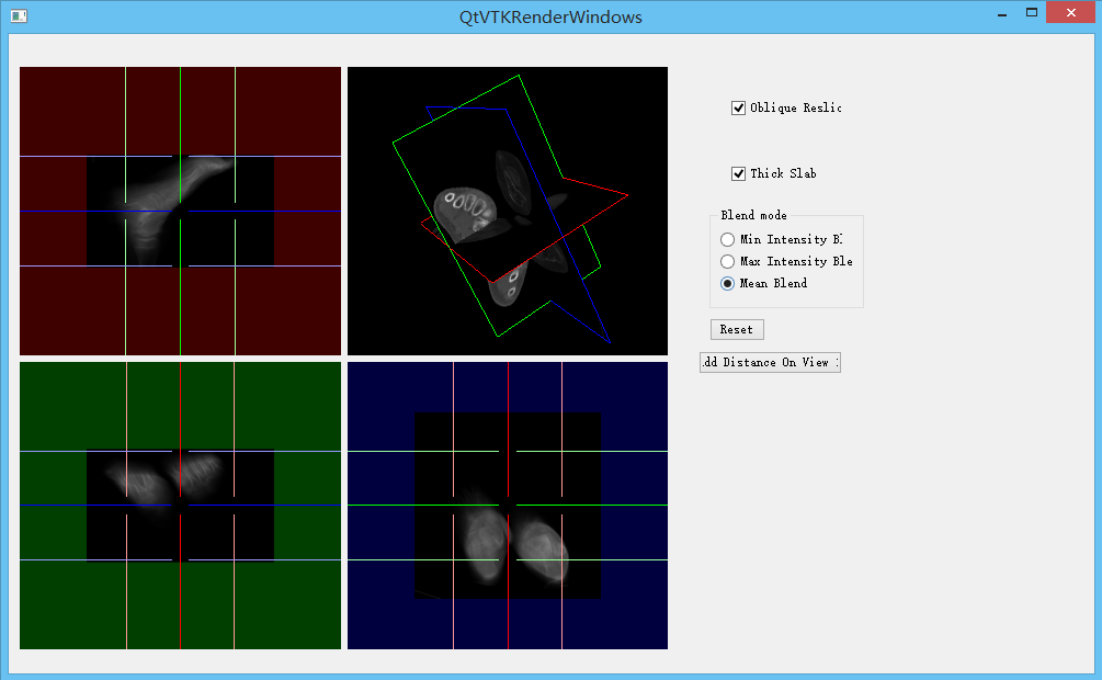 VTK Examples中MIP和MPR的功能实现与源码分析_vtk mip-CSDN博客