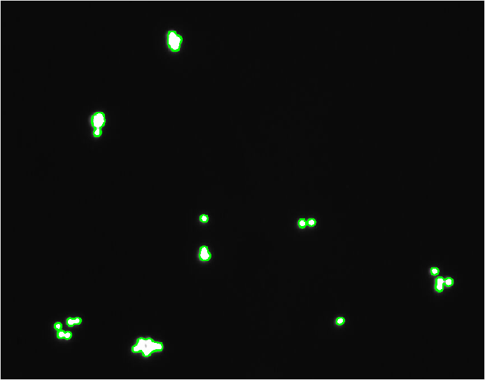 Opencv 识别细胞图中的细胞总数open Cv 细胞识别 Csdn博客