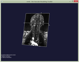 VMTK【1】Getting Started_vmtk pypepad-CSDN博客