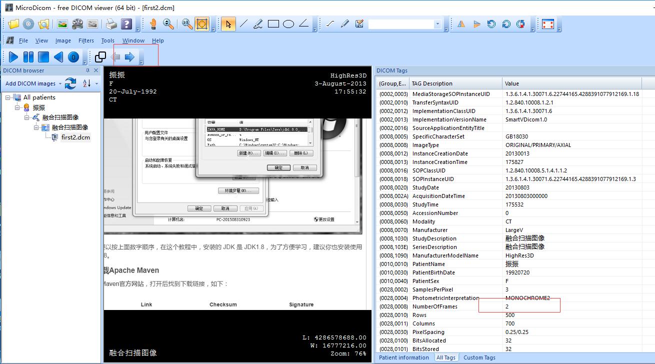 多幅bmp图像数据存入dcm文件 Java 實現bmp转dicom Csdn博客 