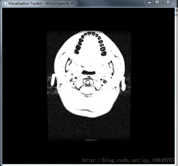 3 Vtk读取并显示dicom文件vue Dcm Vtk Csdn博客 