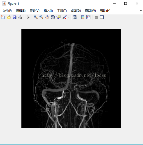 图像处理dicom医学图像处理读取dicom在xy平面投影 Csdn博客 