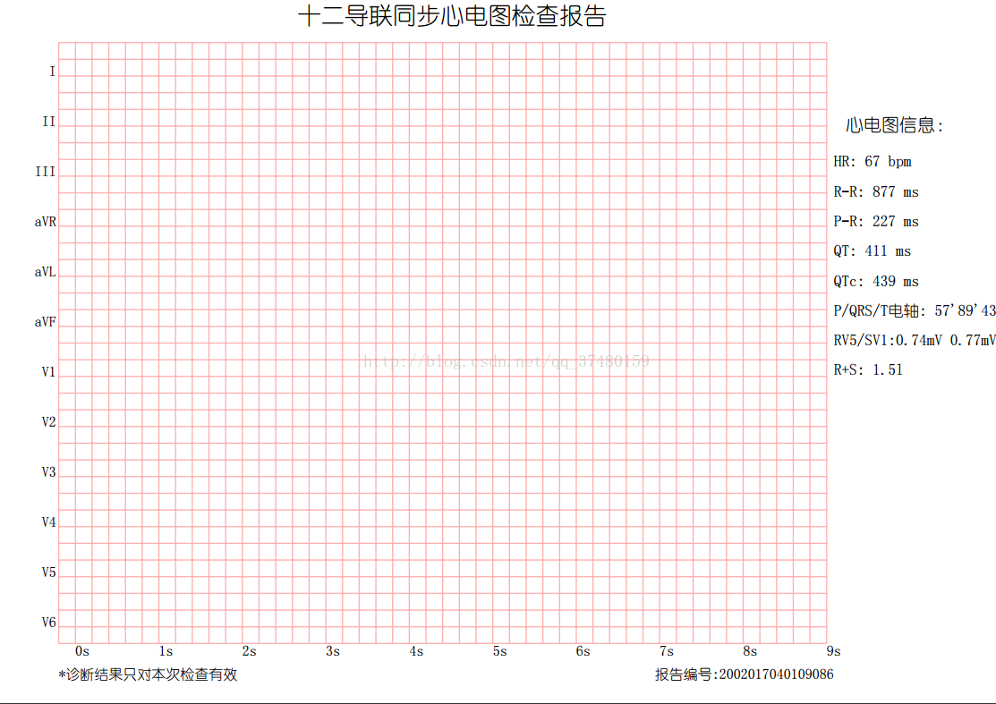 Itext7生成心电图pdf报告 Csdn博客 
