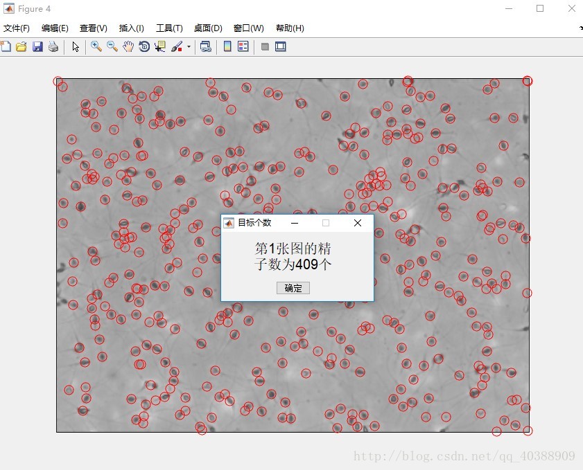 Matlab图像处理关于细胞计数极致侠客的博客 Csdn博客数字图像处理细胞识别计数 