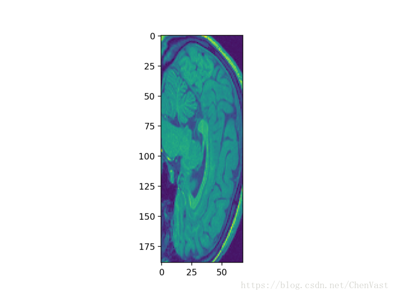 【matplotlib】matplotlib 查看3d体积 实战python Matplotlib 体积 Csdn博客